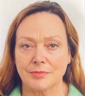 About the Guest Editors | Breaking the bias: standardized methods ...