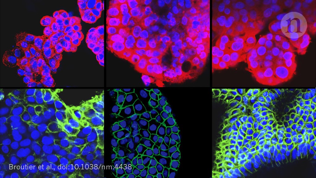 Cells form mini liver tumours in a dish