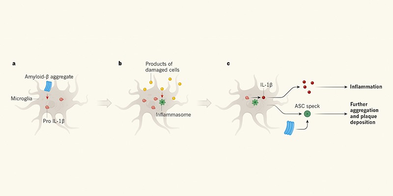 Specks of insight into Alzheimer’s disease
