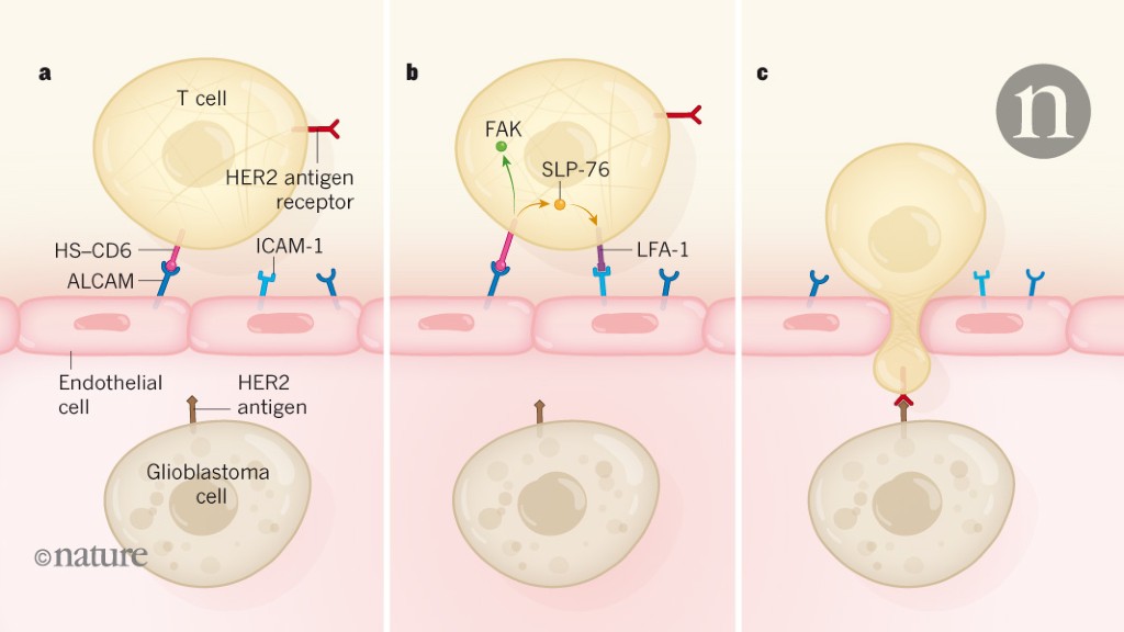 T cells engineered to home in on brain cancer