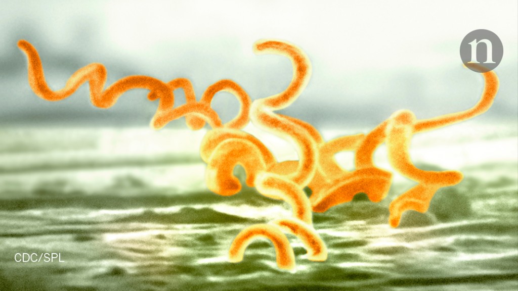 Syphilis cases in US newborns spike to 20-year high