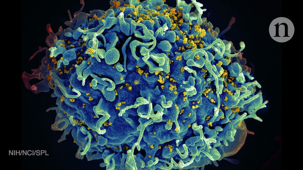 Virus detectives test whole-body scans in search of HIV’s hiding places