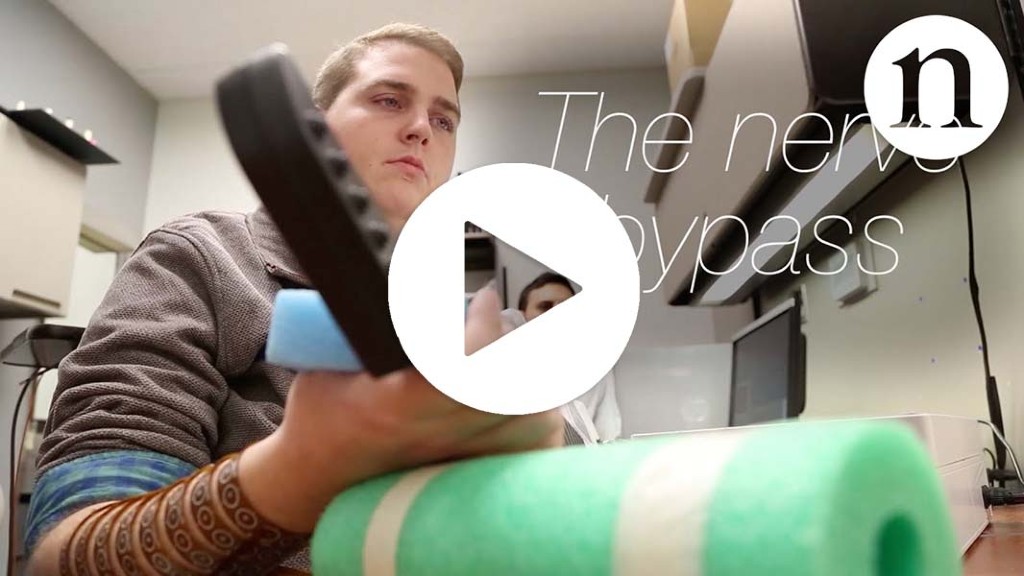 The nerve bypass: how to move a paralysed hand