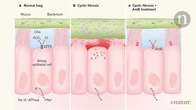 Pore-forming small molecules offer a promising way to tackle cystic ...