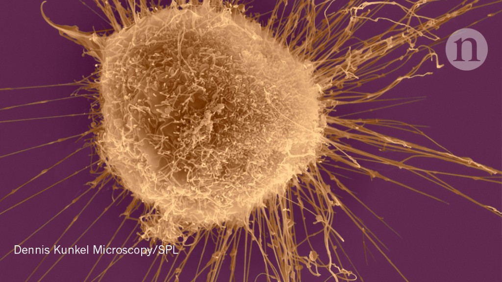 How DNA ‘hotspots’ snarl the search for cancer genes