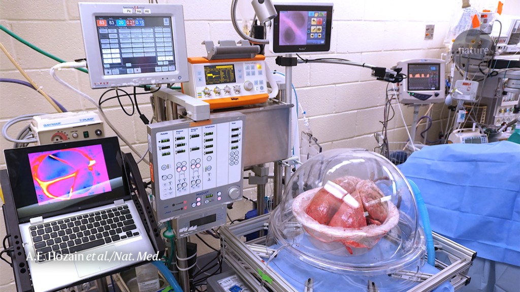 How to use a live pig to revitalize a human lung