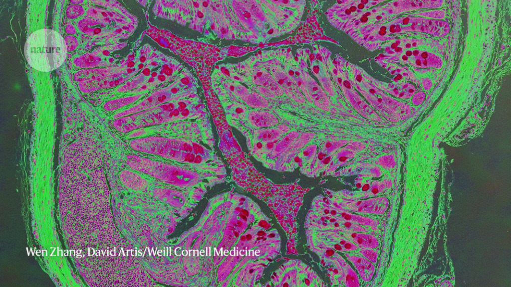 The surprise saviours of the gut: the neurons that sense pain