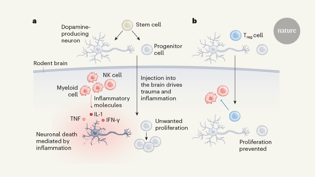 Regulatory T cells aid stem-cell therapy for Parkinson’s disease
