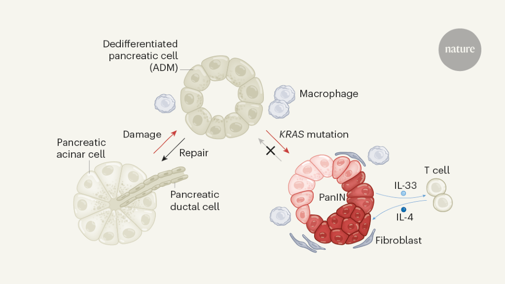 Calligraphy tool offers clues to the origin of pancreatic cancer