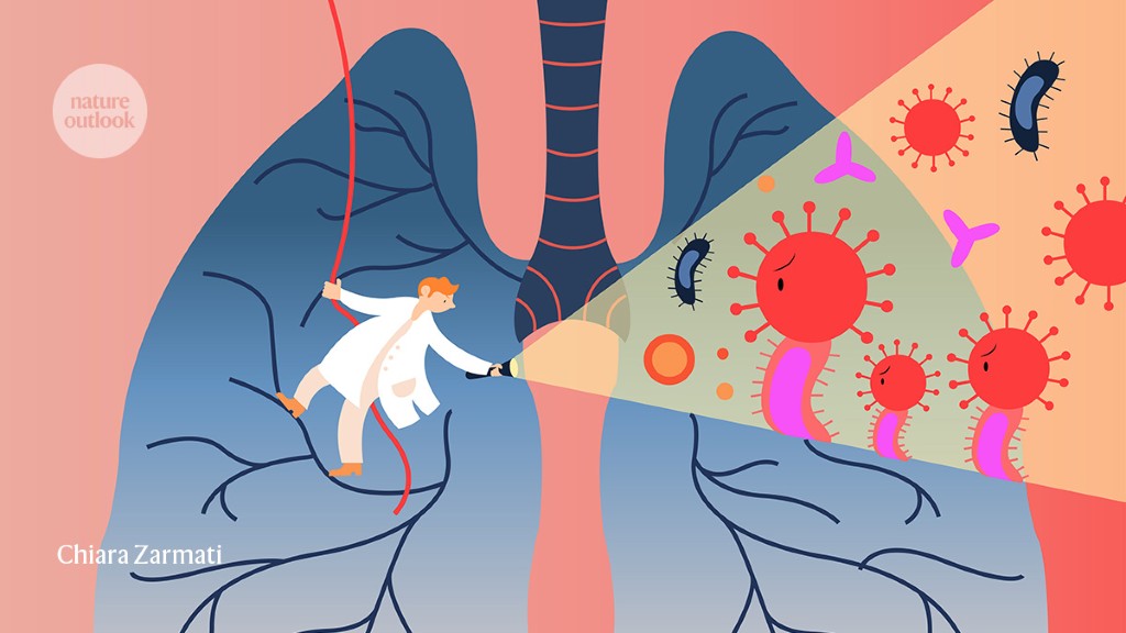 Respiratory syncytial virus co-infections might conspire to worsen disease