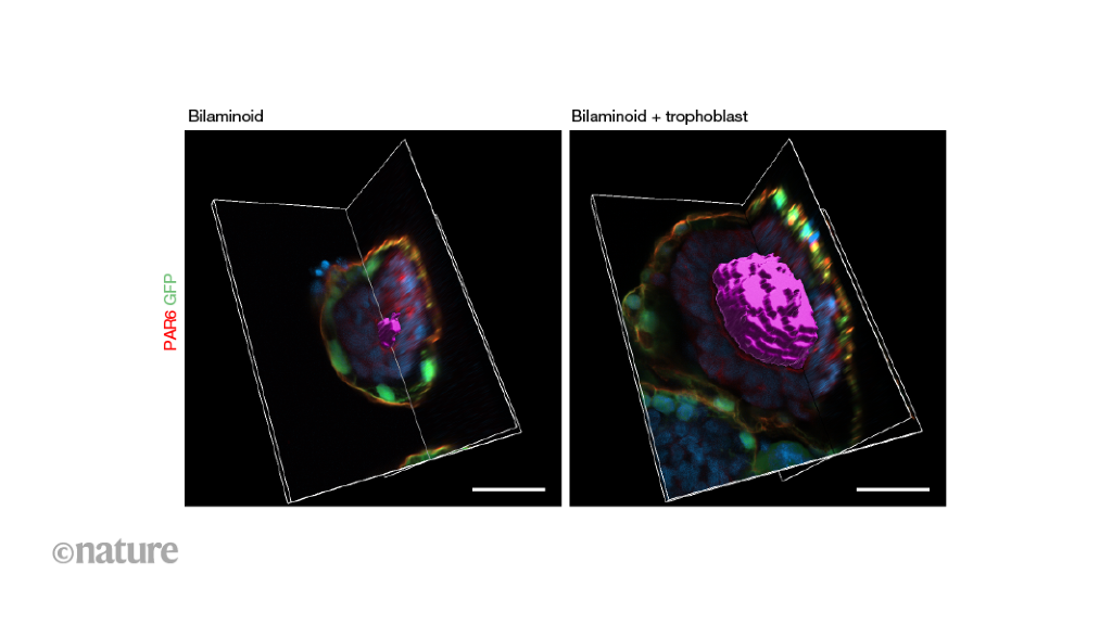 Embryo model made using pluripotent stem cells reveals details of early ...