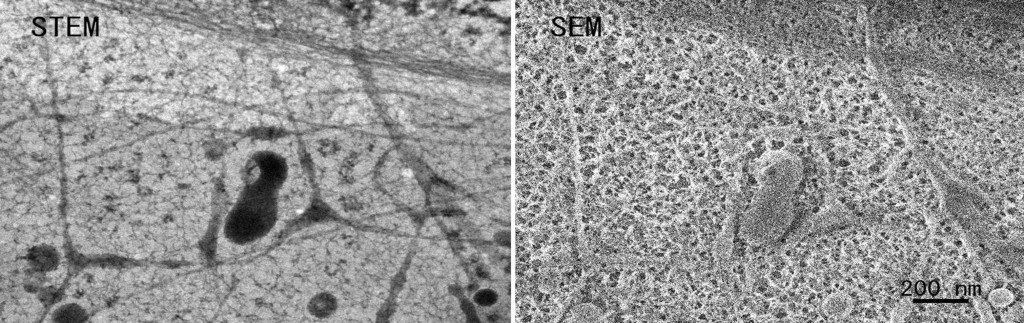 Good sample preparation is the key to getting the best from cryo ...