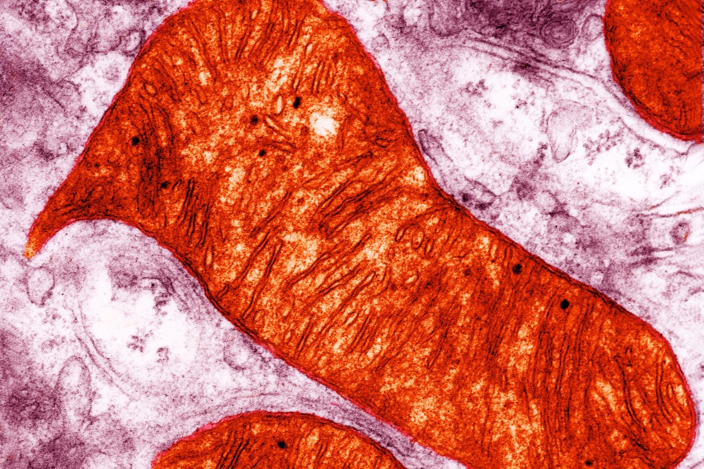 The many faces of a mitochondrial mutation