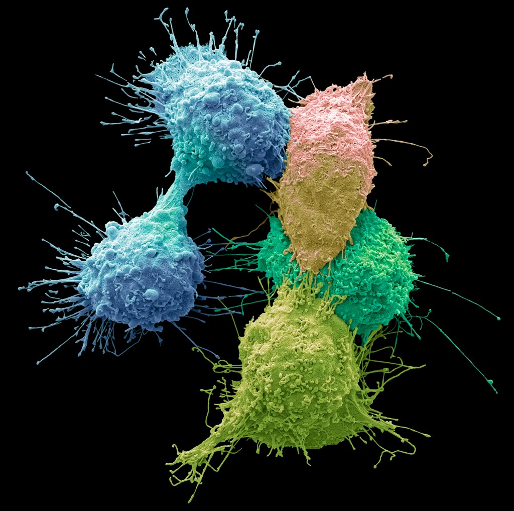 Analysing cancer at the single-cell level