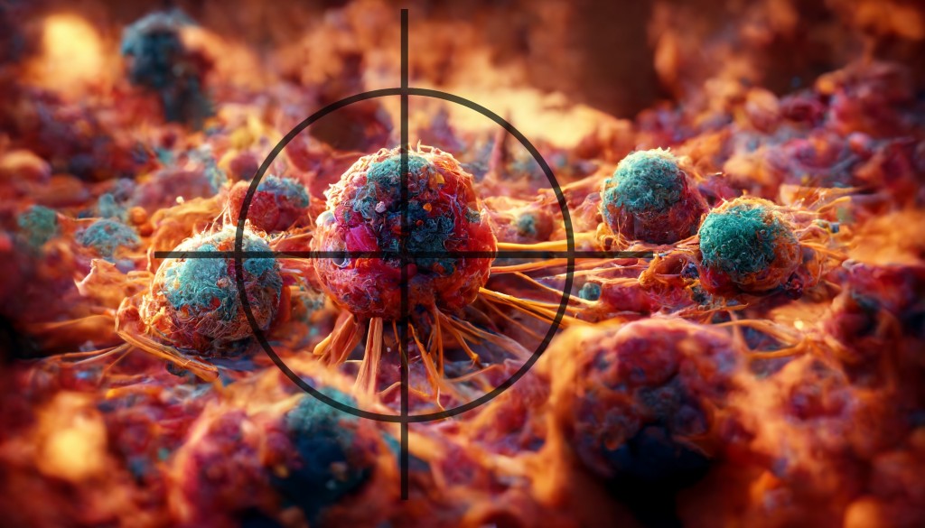 Precision immunotherapy gives cancer nowhere to hide