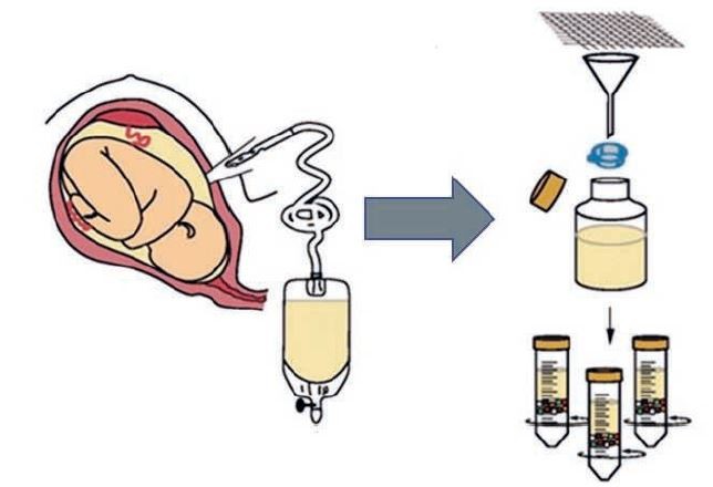Neonatal, tissue-specific stem cells for next-generation cell therapies