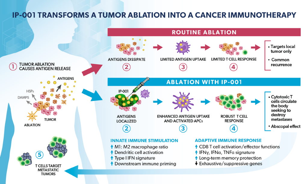 Interventional immuno-oncology: a transformational approach to treat ...
