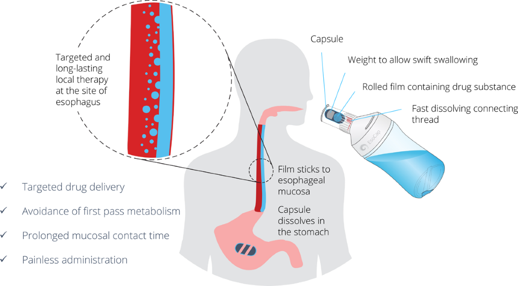 Building a smart drug delivery technology for the esophagus