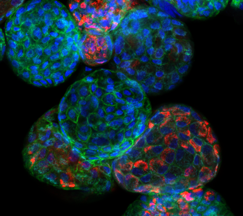 Exploring liver organoids