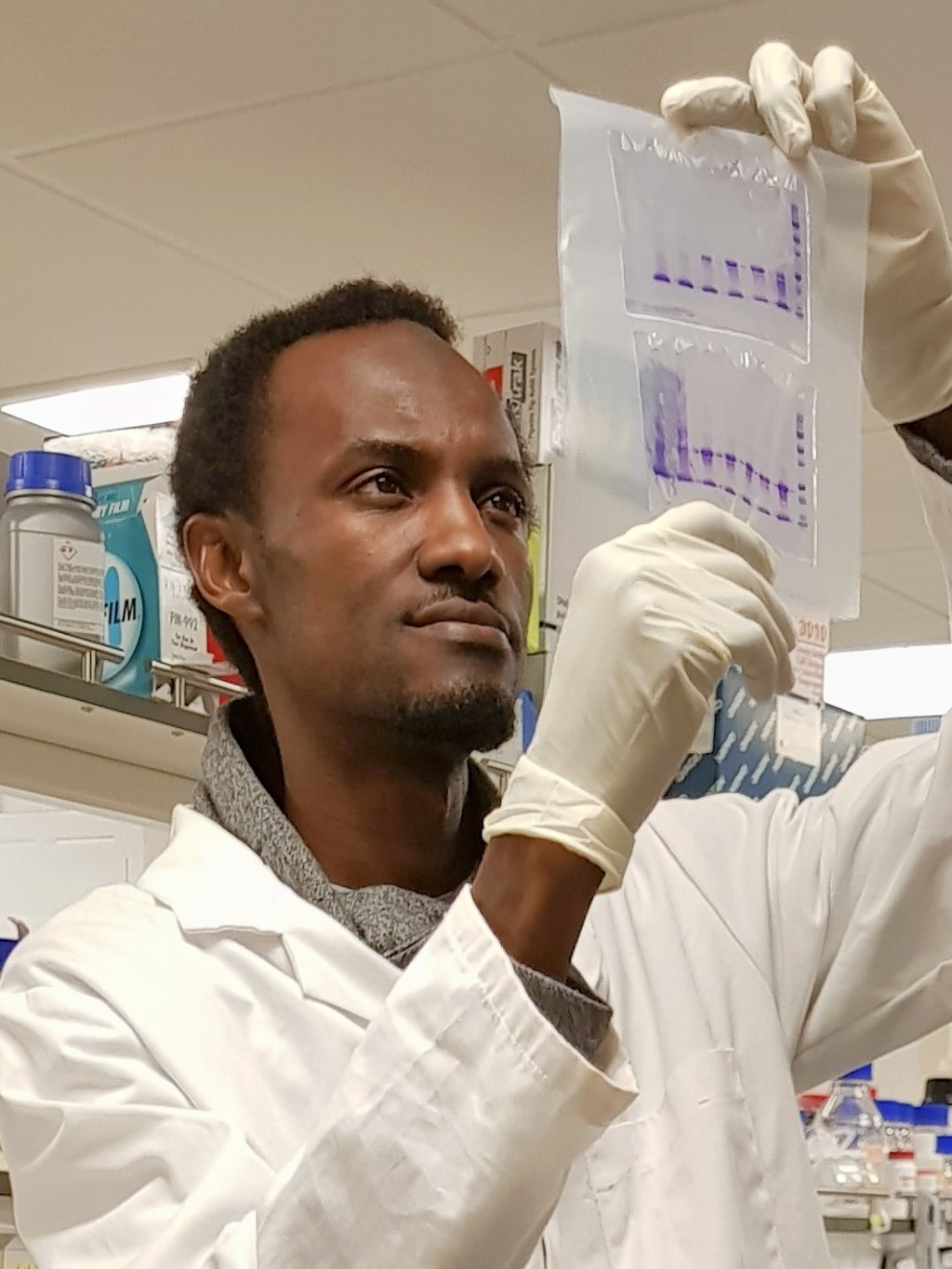 Cohesion needed to improve neuroscience research in Africa