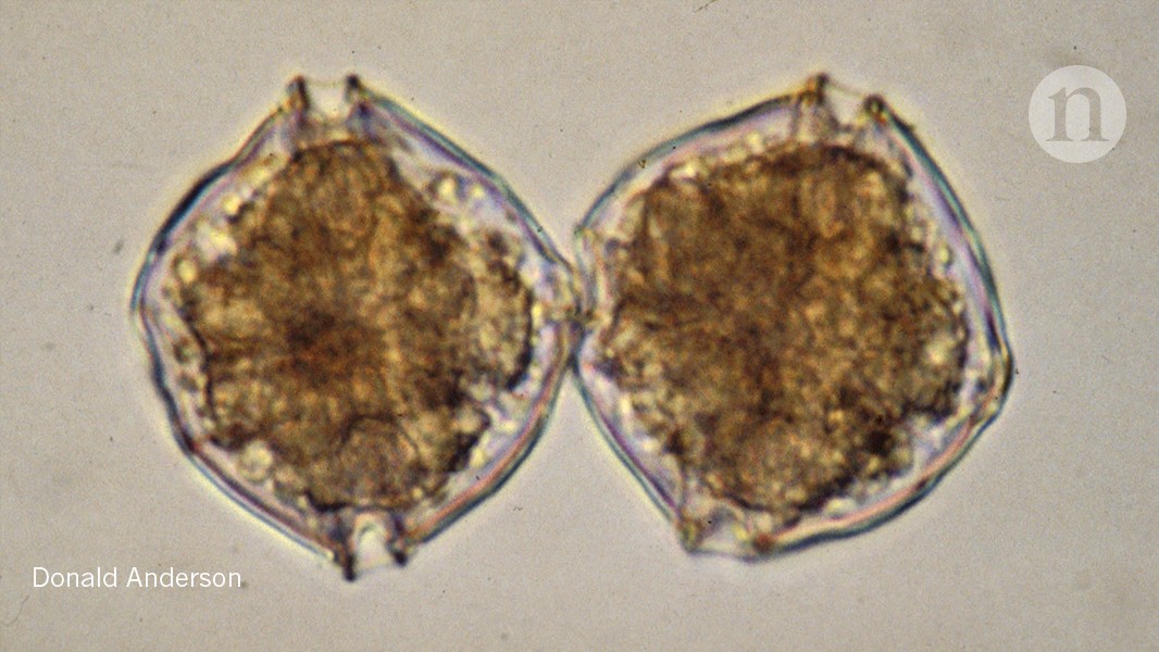 How bacteria build a deadly toxin