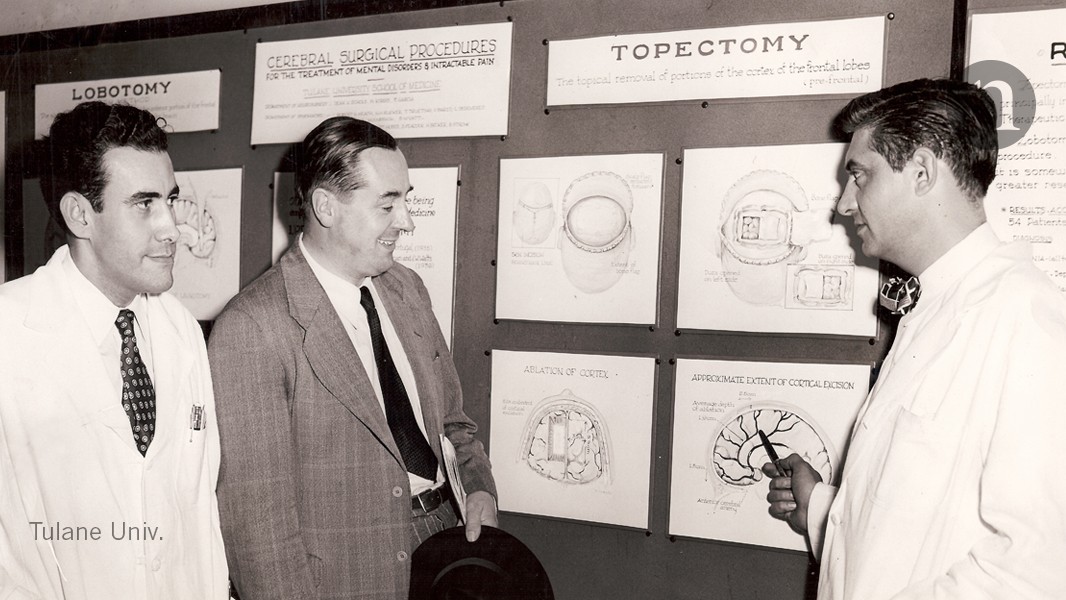 Dark past of deep-brain stimulation