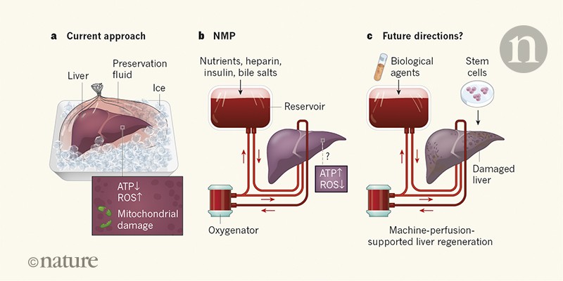 Life of a liver awaiting transplantation
