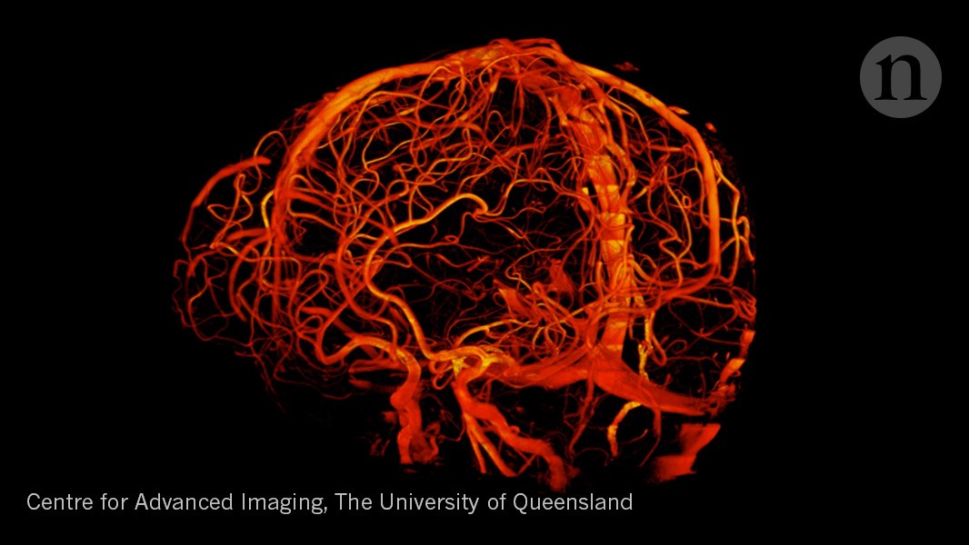 The world’s strongest MRI machines are pushing human imaging to new limits