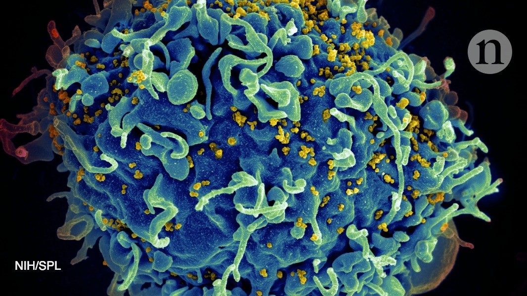 Second patient free of HIV after stem-cell therapy