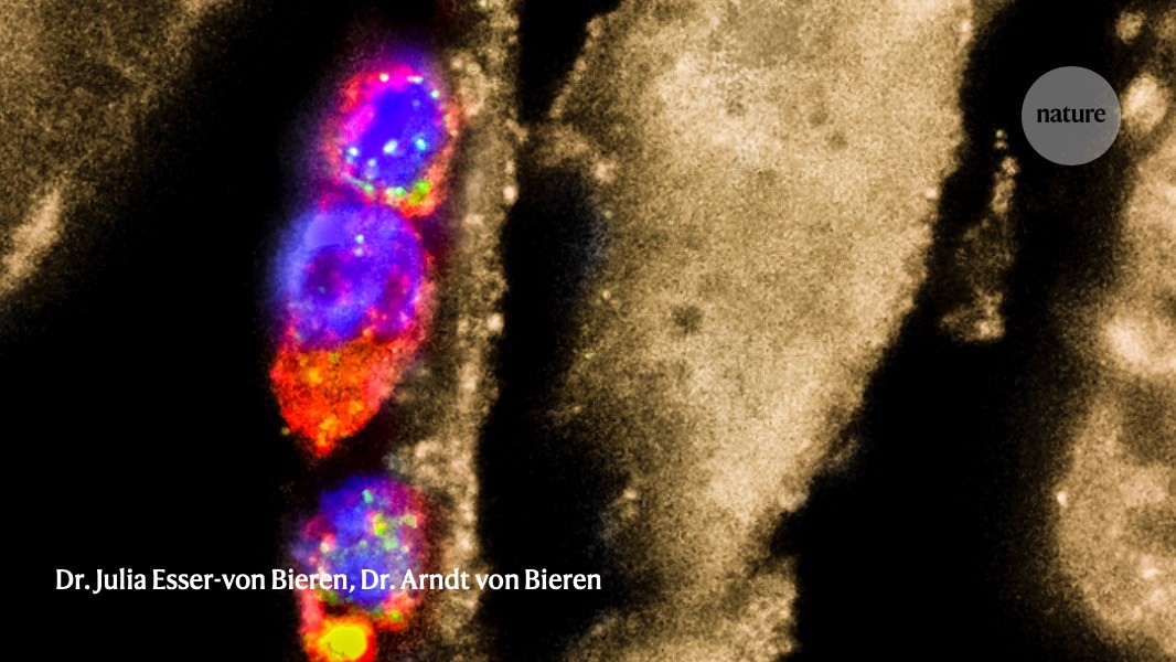 A worm that infests mouse guts supplies a remedy for inflammation