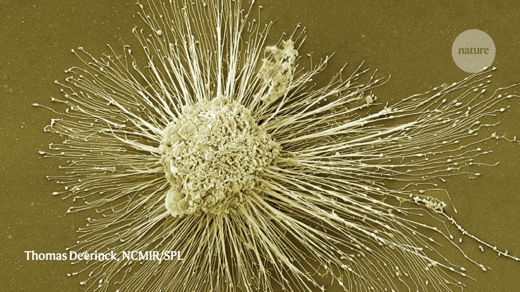 Revealed: two men in China were first to receive pioneering stem-cell ...