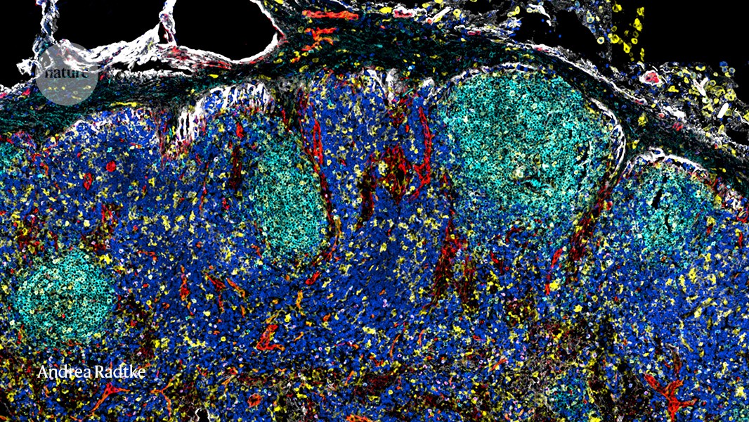 Tissues, not blood, are where immune cells function