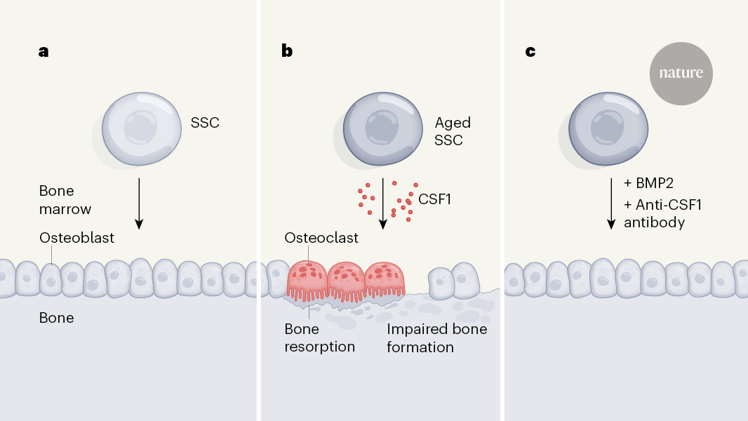 A stem-cell basis for skeletal ageing