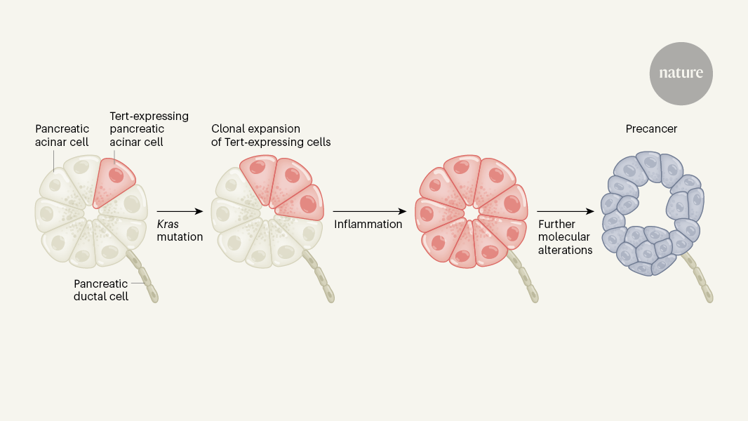 Insights into the origins of pancreatic cancer