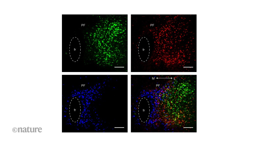 Tracing the brain circuitry underlying movement and mood symptoms in ...