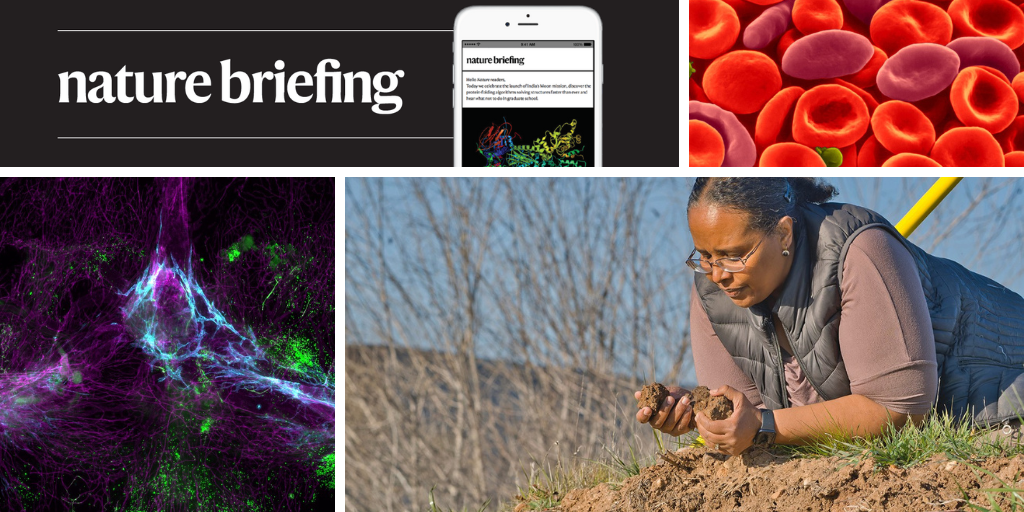 Daily briefing: The brain is an ‘immunological wonderland’