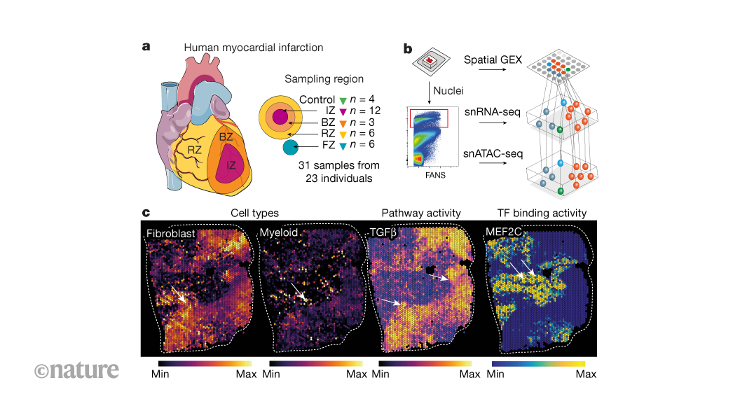 A map of the human heart after myocardial infarction