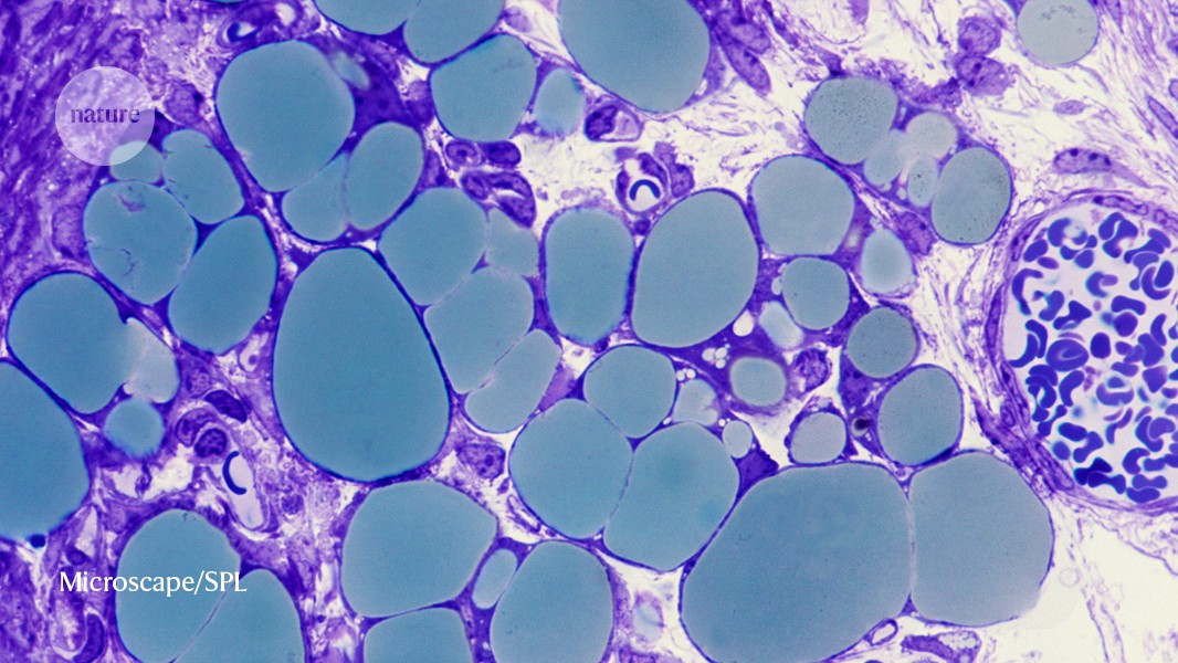 Exercise triggers fat breakdown at some times of day and not others