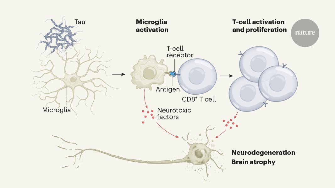 Activated immune cells drive neurodegeneration in an Alzheimer’s model