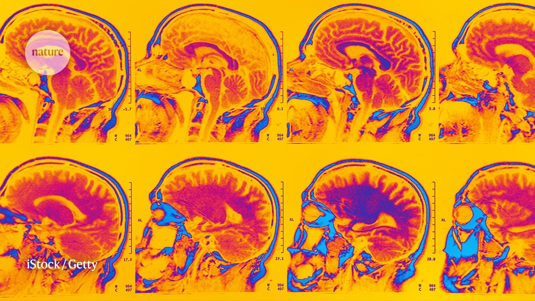 ‘Intention is not action’: brain-research centre steps up quest for ...