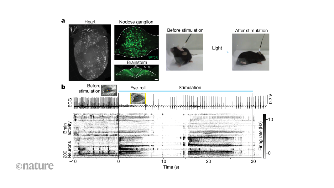 Identification of neuronal connections between heart and brain that ...