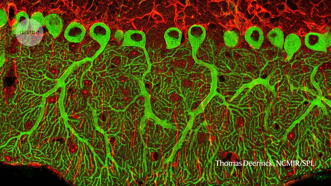 Why mega brain project teams need to be talking to each other