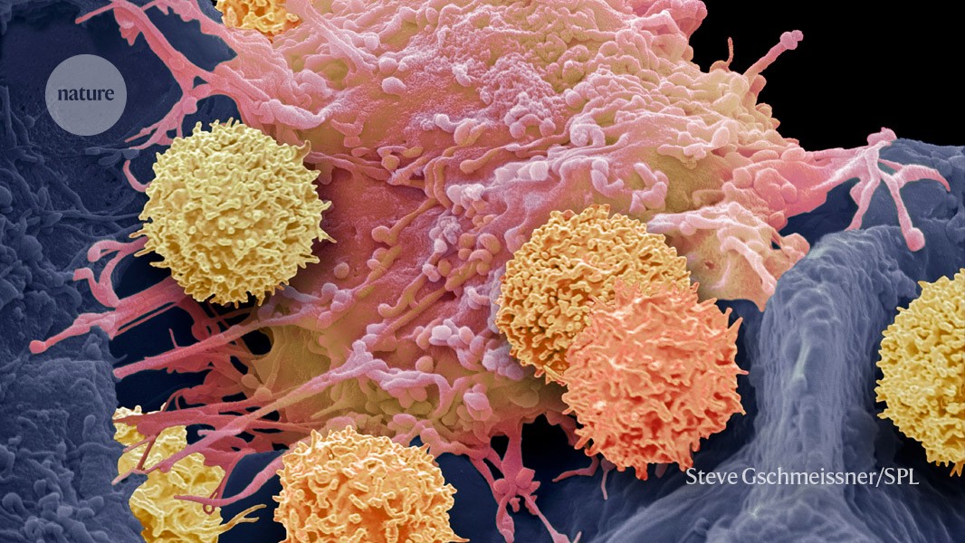 ‘It’s all gone’: CAR-T therapy forces autoimmune diseases into remission