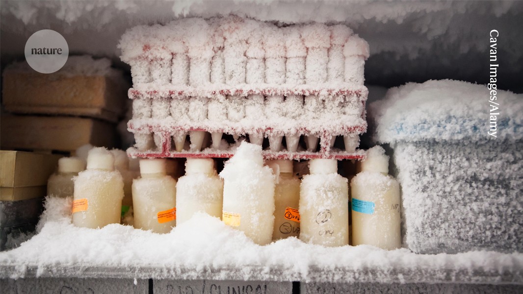 Organize your –80 °C freezer to save time and prevent frozen fingertips