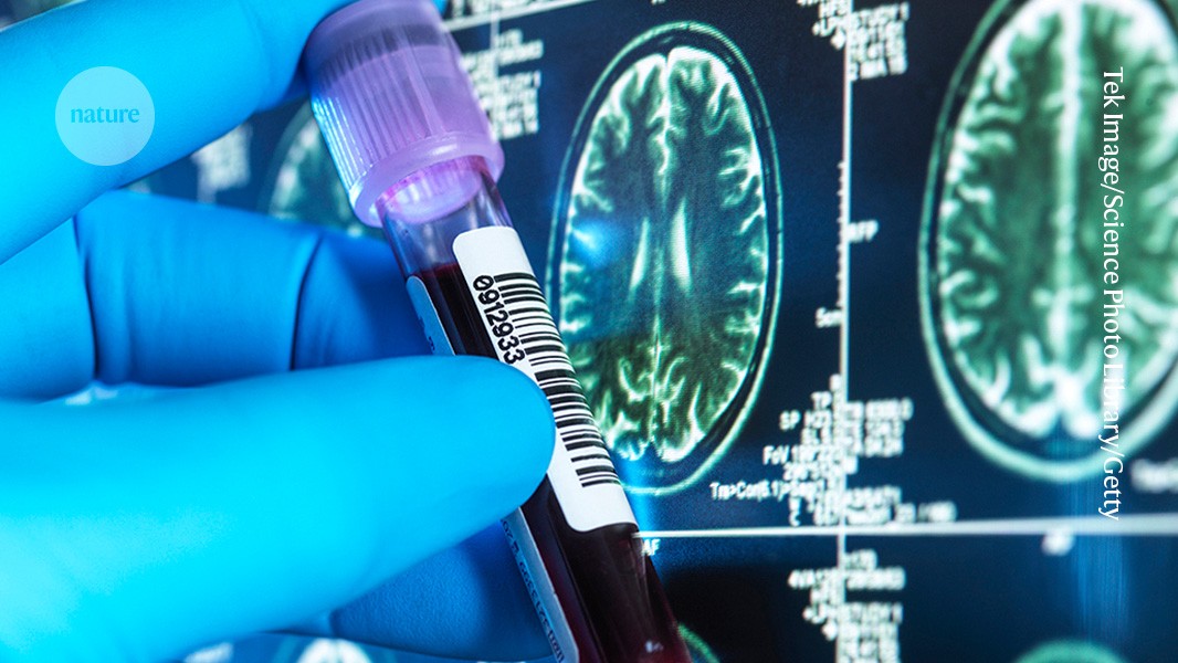 2020: A blood-borne biomarker for Alzheimer’s disease