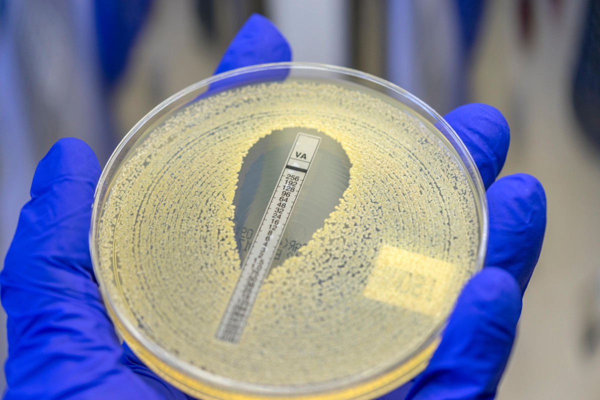 Amino acid analyzers help the search for new biotherapeutics