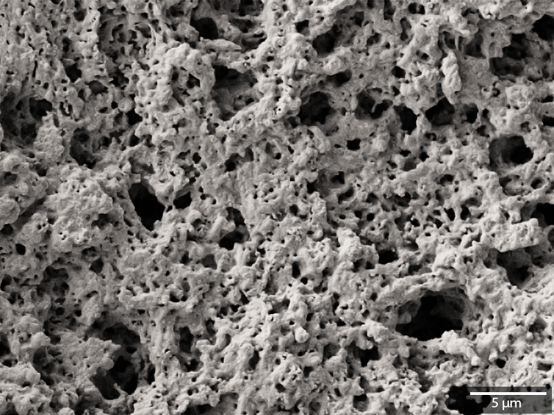 Artificial bone that beats the real thing