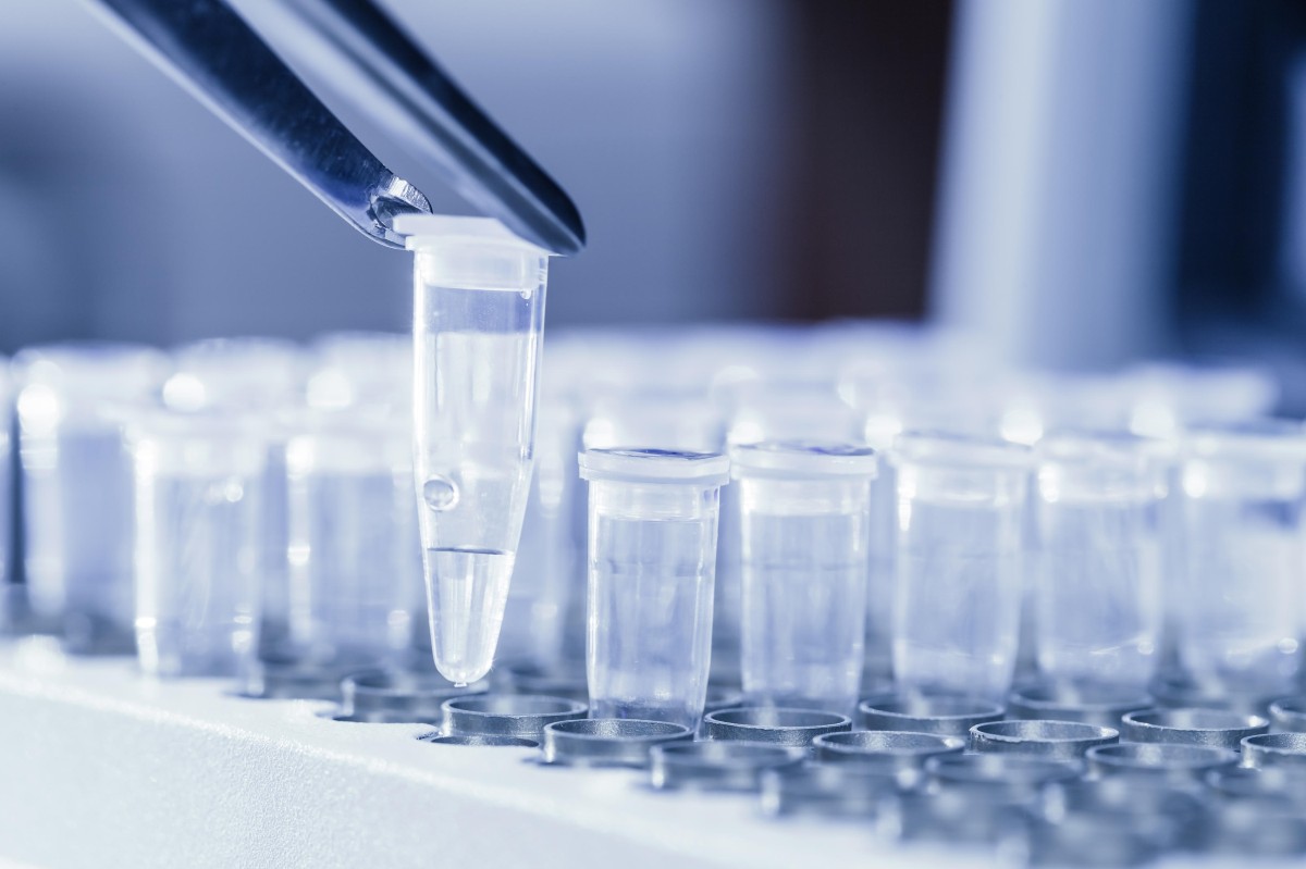 The rise of qPCR testing in clinical diagnostics