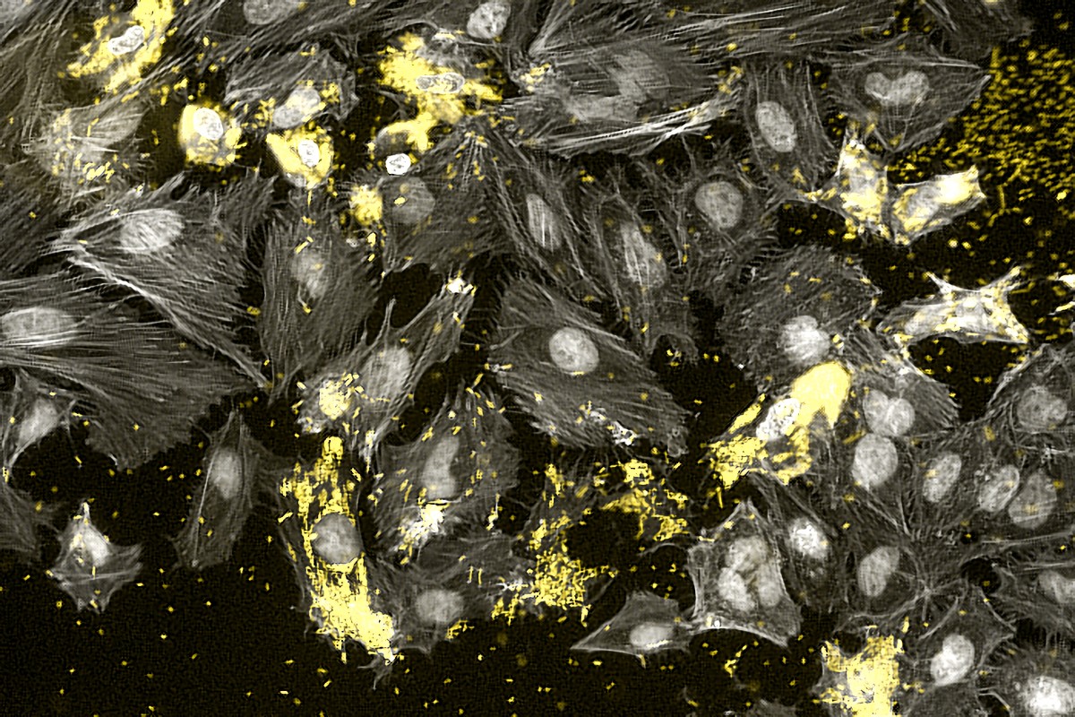 Drug and bug interactions win life sciences prize