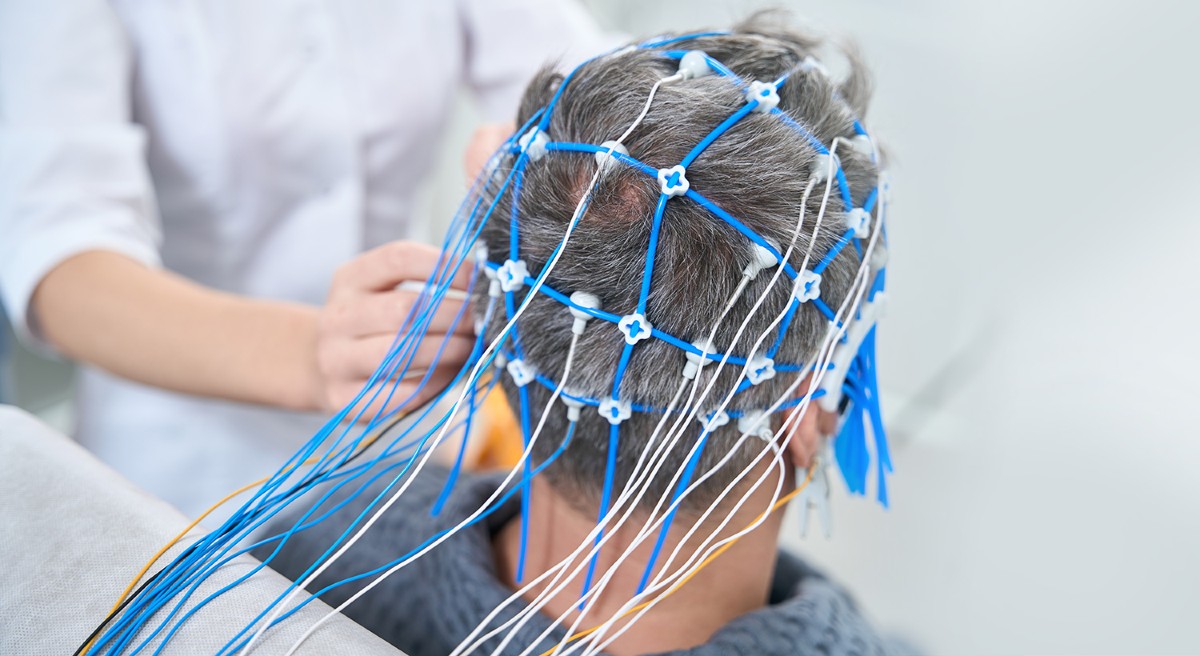 How brain waves hint at early signs of dementia